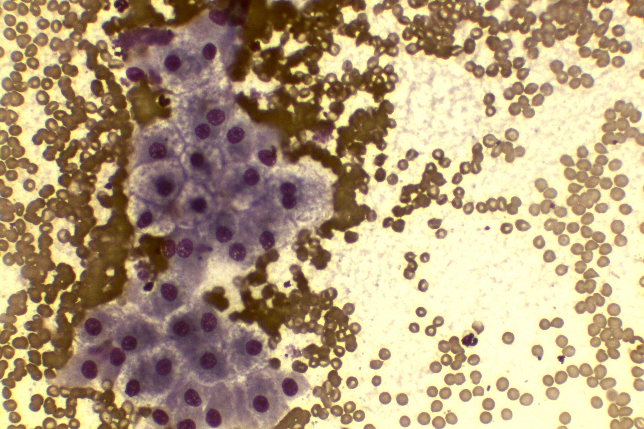 ¿Puedo realizar una citología de hígado a mi paciente? - Citopet